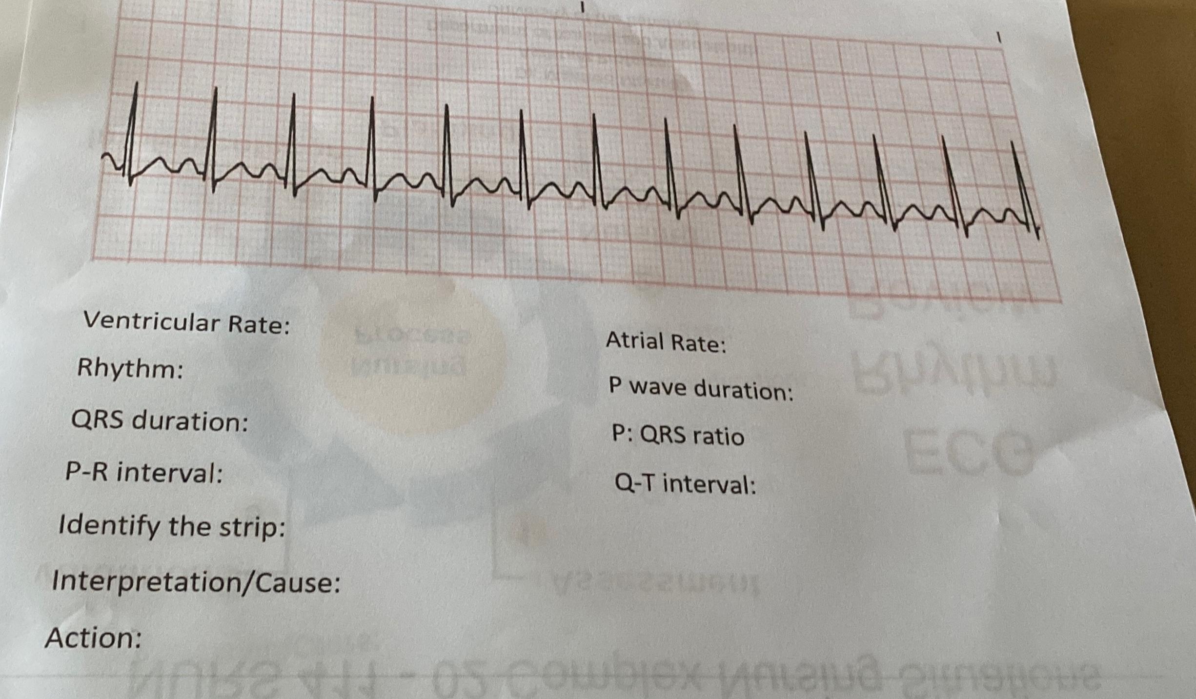 Solved Ventricular Rate:Rhythm:QRS duration:P-R | Chegg.com
