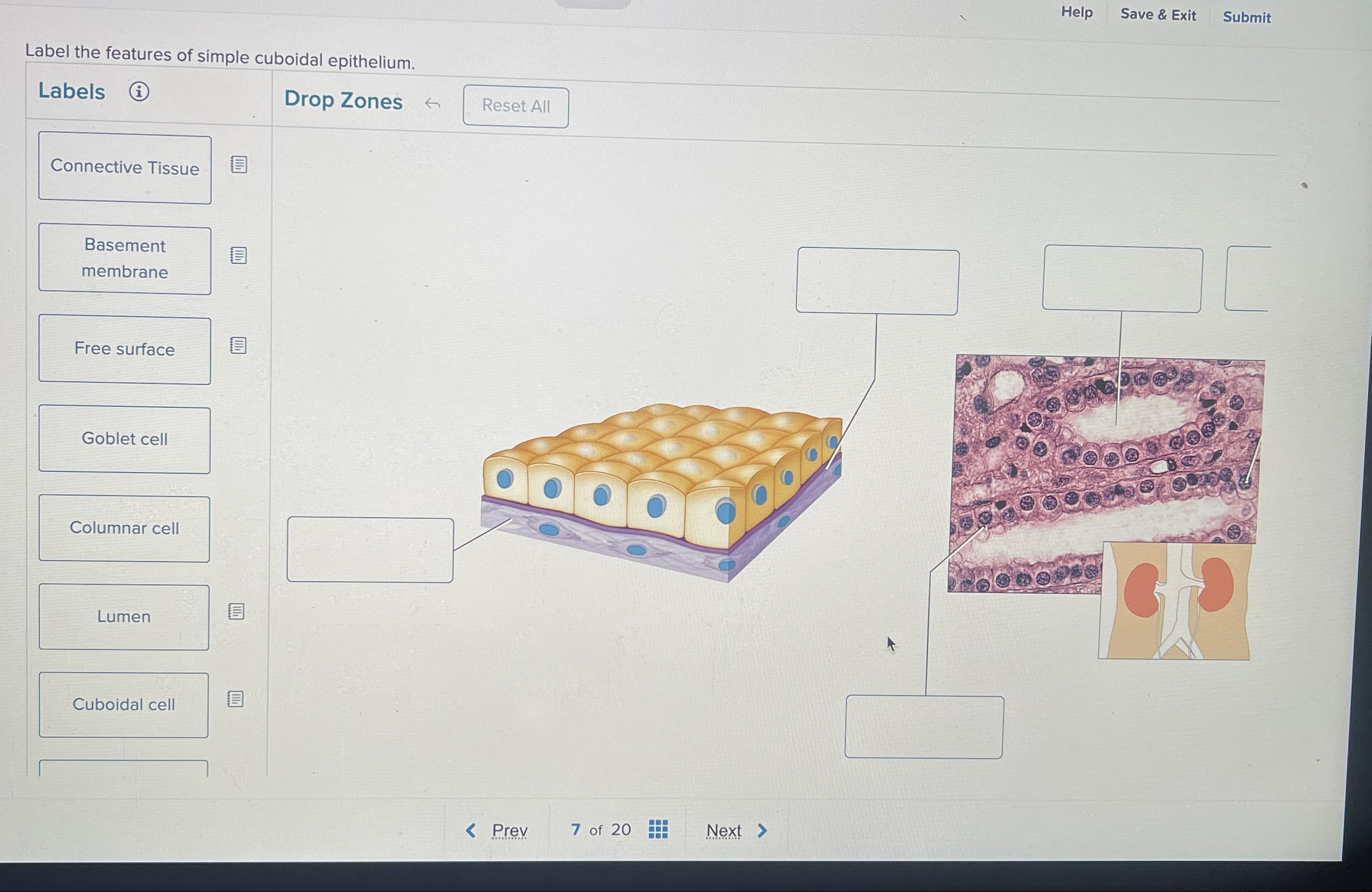 Solved Help Save & Exit SubmitLabel the features of simple | Chegg.com