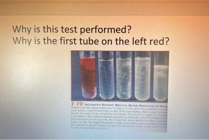 Solved Identify this test. Which tube shows a positive | Chegg.com