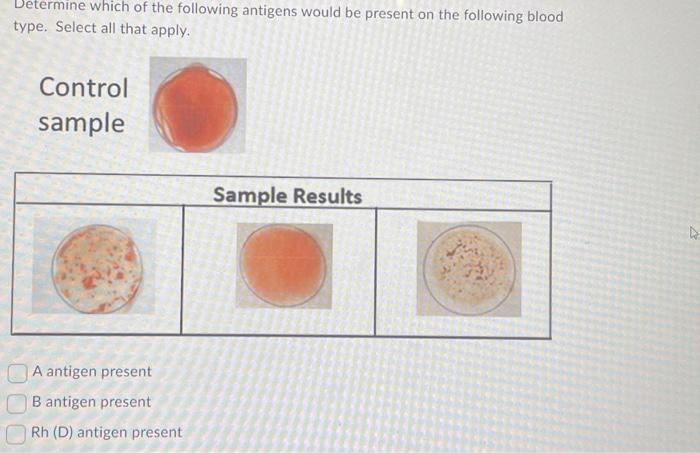 Solved Determine which of the following antigens would be | Chegg.com