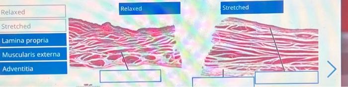 Solved Relaxed Relaxed Stretched Stretched Lamina propria | Chegg.com