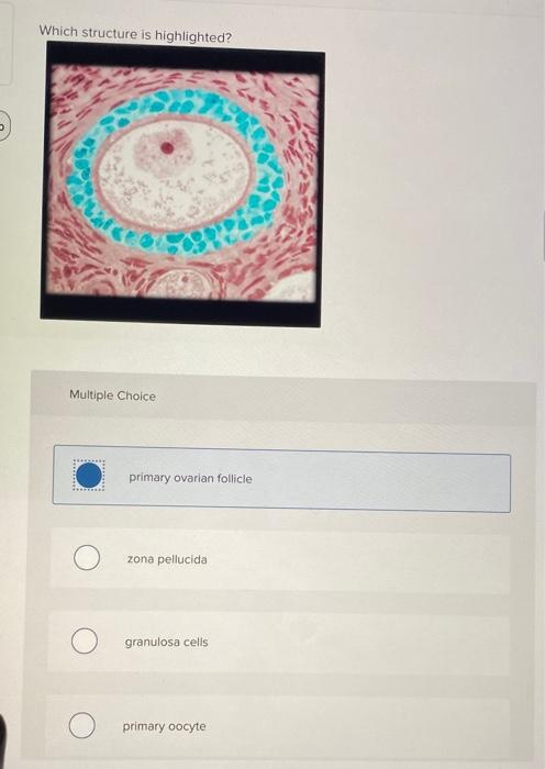 Solved Which structure is highliahted? Multiple Choice | Chegg.com