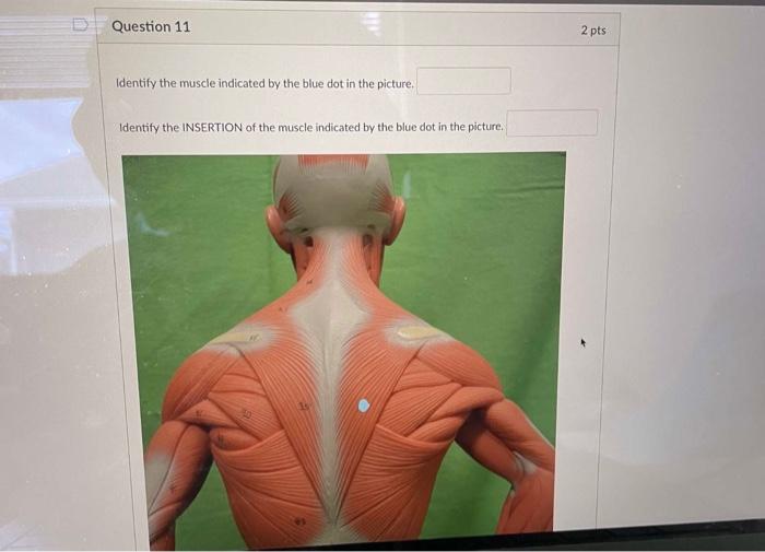 Solved Question 11 2 pts Identify the muscle indicated by | Chegg.com
