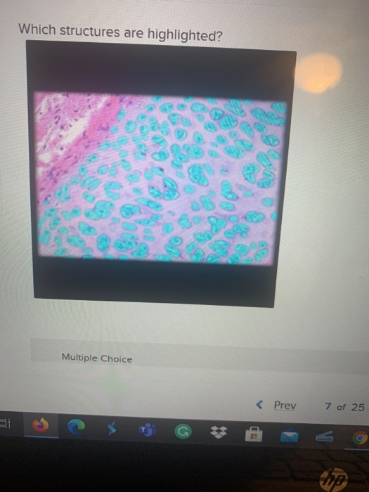 Solved Which structures are highlighted? Multiple Choice