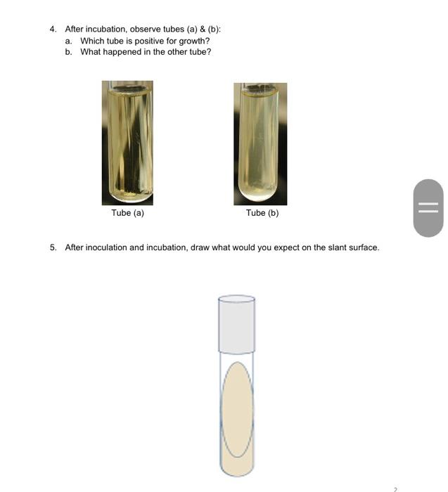 Solved 4. After incubation, observe tubes (a) & (b): a. | Chegg.com