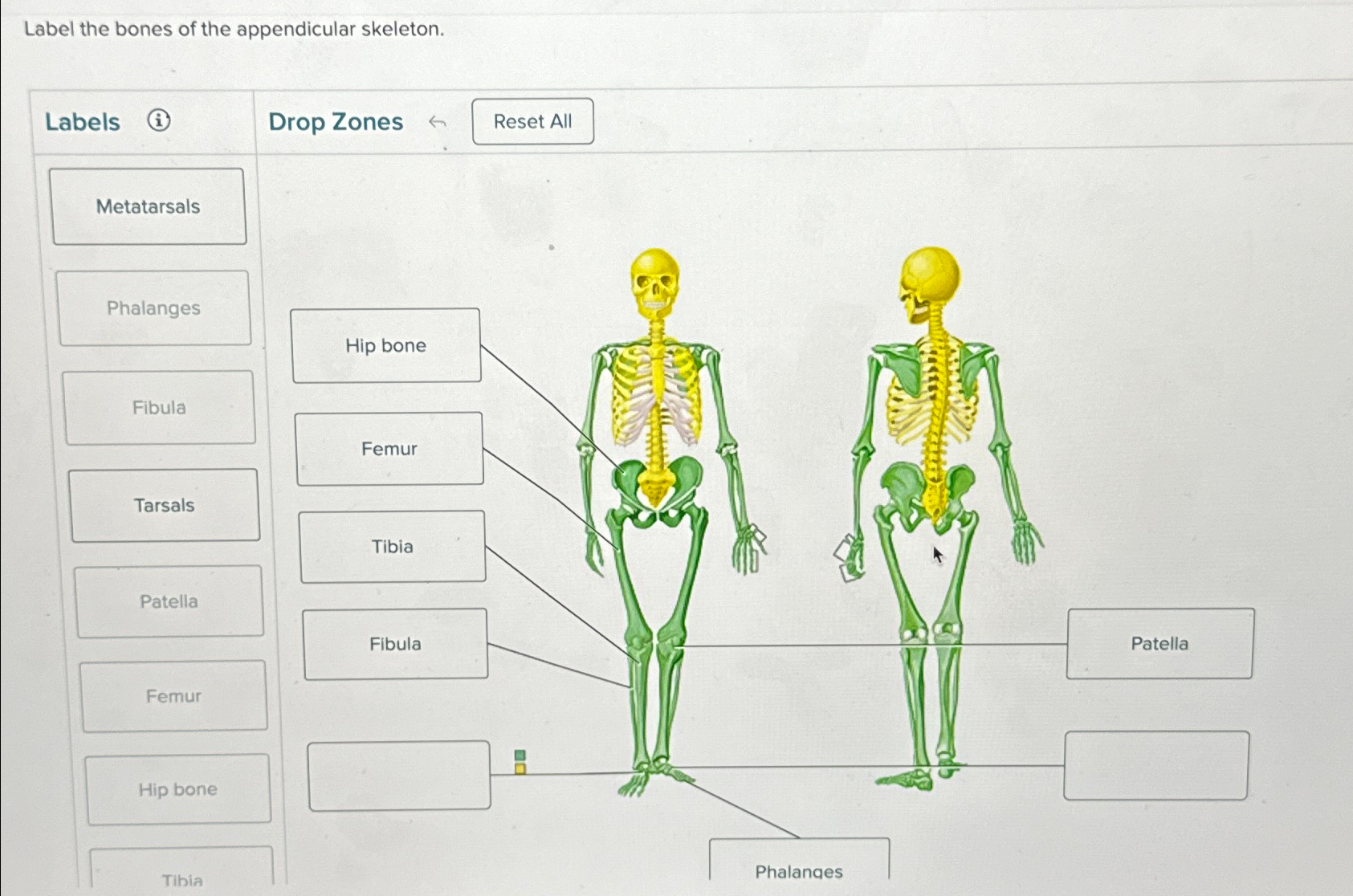 Solved Label the bones of the appendicular skeleton. | Chegg.com