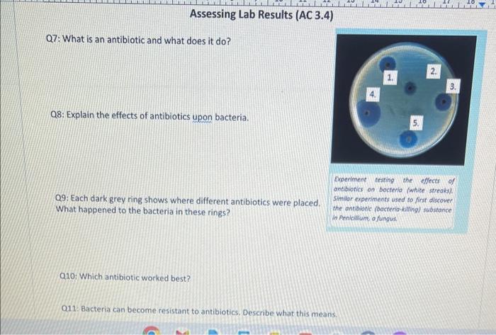Solved Assessing Lab Results (AC 3.4) Q7: What is an | Chegg.com