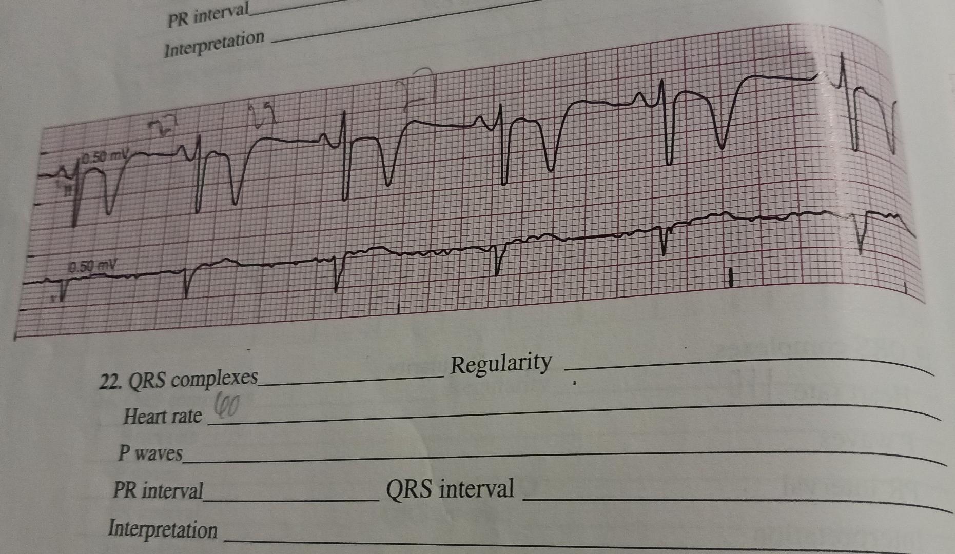 Solved 22. QRS complexes Regularity Heart rate P waves PR | Chegg.com