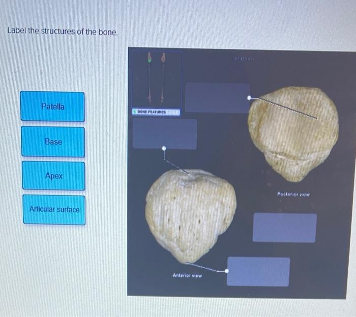 Solved Label the structures of the bone. Patella DON ATURES | Chegg.com