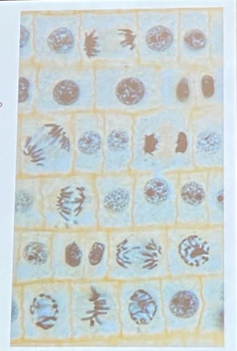 Solved How many Prophase cells in this pictire? How many | Chegg.com