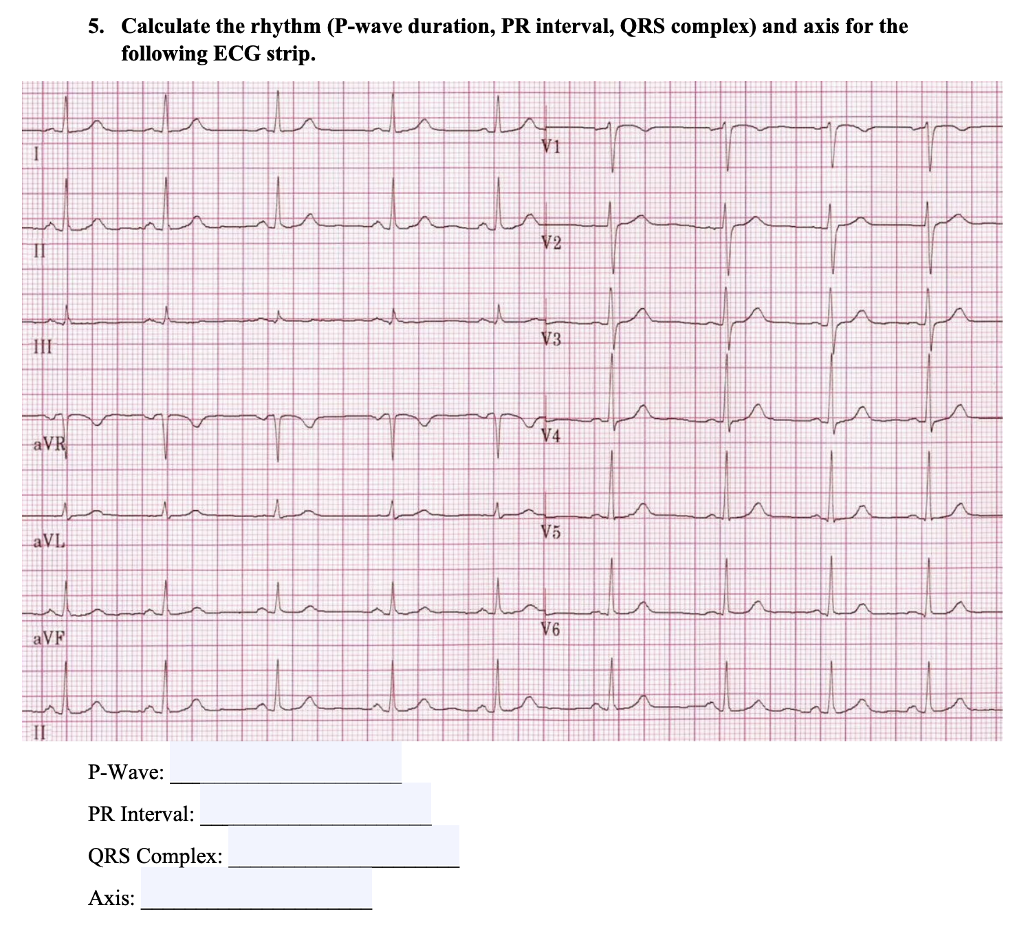 Solved Calculate the rhythm (P-wave duration, PR interval, | Chegg.com