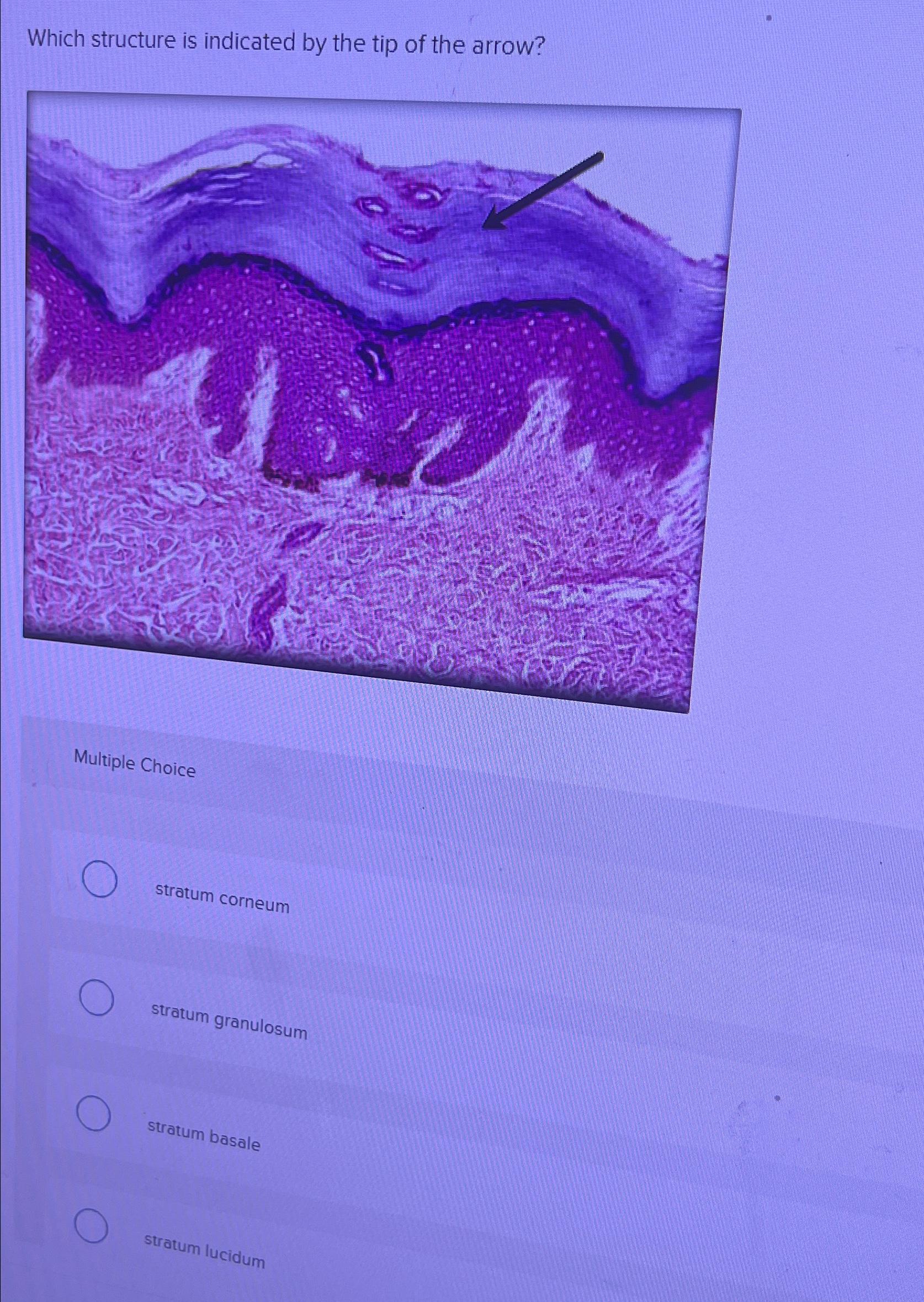 Solved Which structure is indicated by the tip of the | Chegg.com