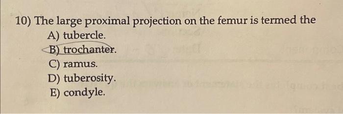 Solved 10) The large proximal projection on the femur is | Chegg.com