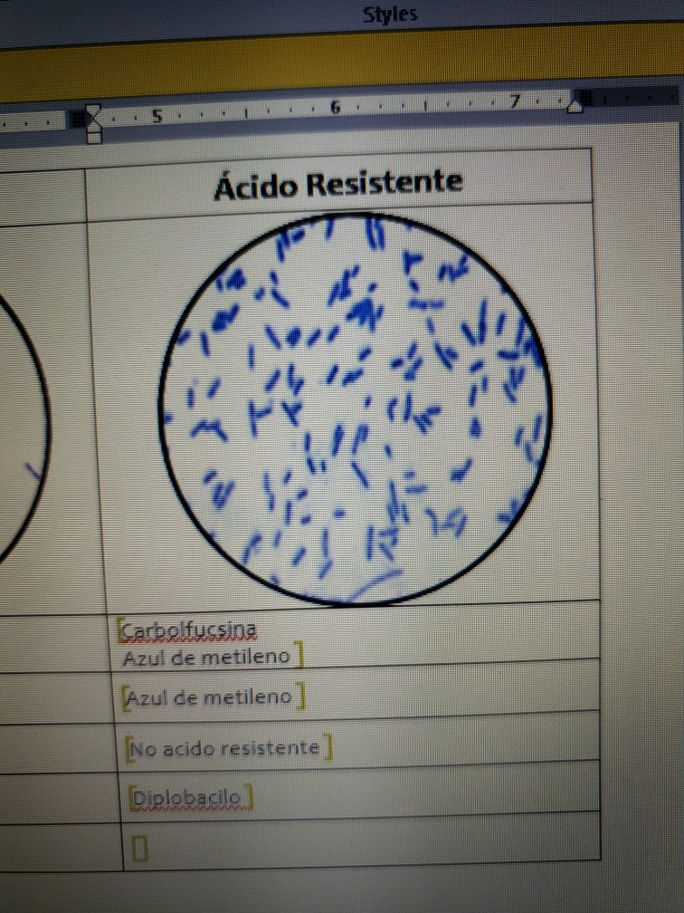 Solved name of a similar non acid fast bacteria that has the | Chegg.com