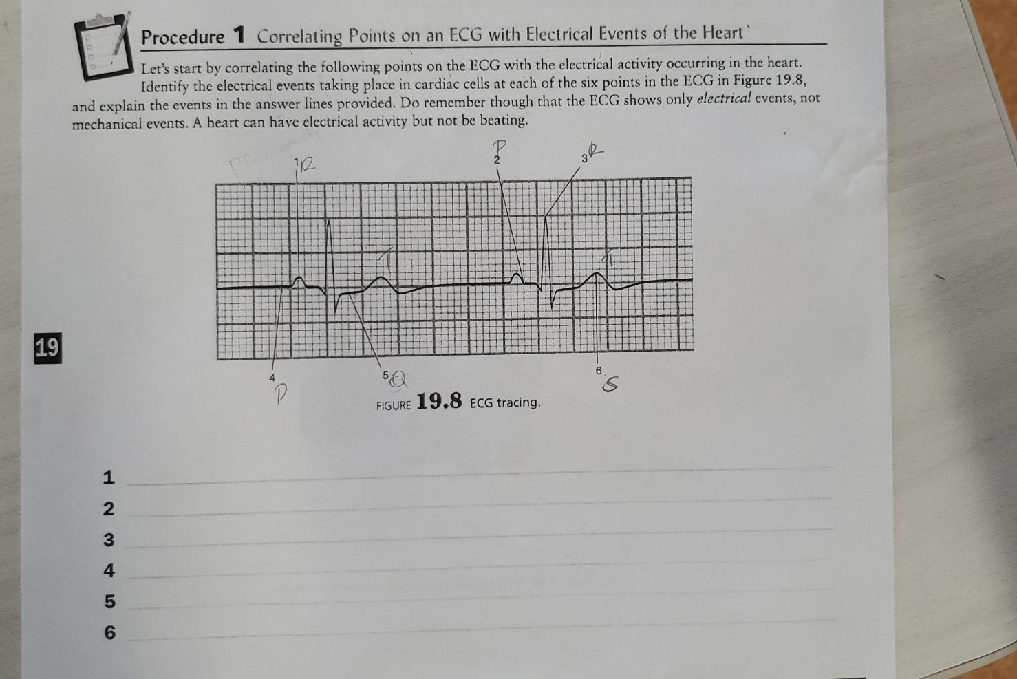Solved Procedure 1 Correlating Points on an ECG with | Chegg.com