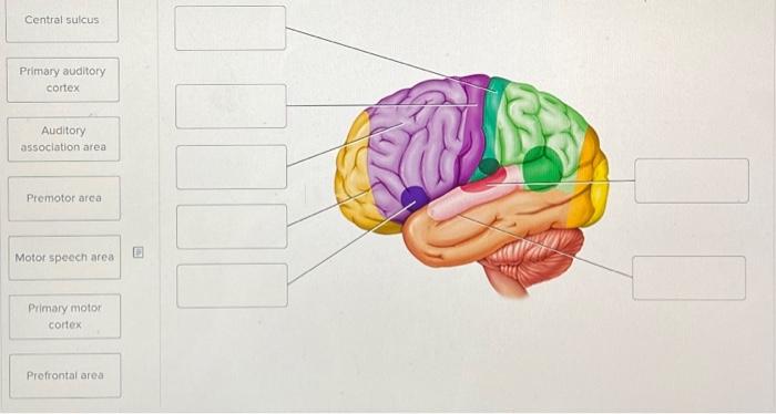 Solved Central sulcus Primary auditory cortex Auditory | Chegg.com