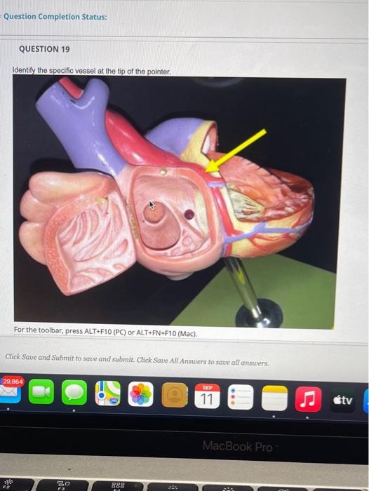 Solved Question Completion Status: QUESTION 19 Identify the | Chegg.com
