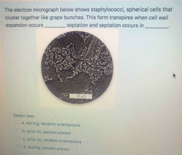 Solved The electron micrograph below shows staphylococci, | Chegg.com