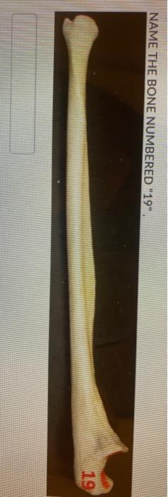 Solved NAME THE BONE NUMBERED "19" 19 | Chegg.com