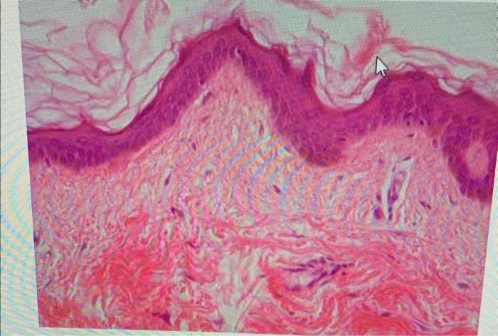 Solved Examine a slide sample of the human scalp. Draw what | Chegg.com