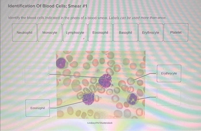 Solved Identification Of Blood Cells; Smear \#1 Identify the | Chegg.com