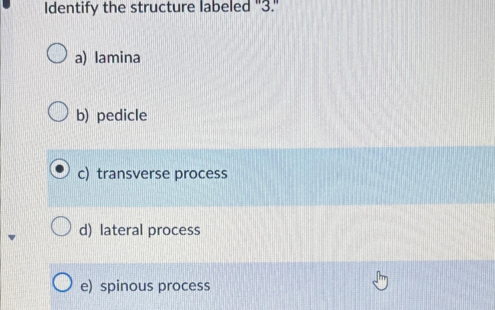Solved Identify the structure labeled "3."a) ﻿laminab) | Chegg.com