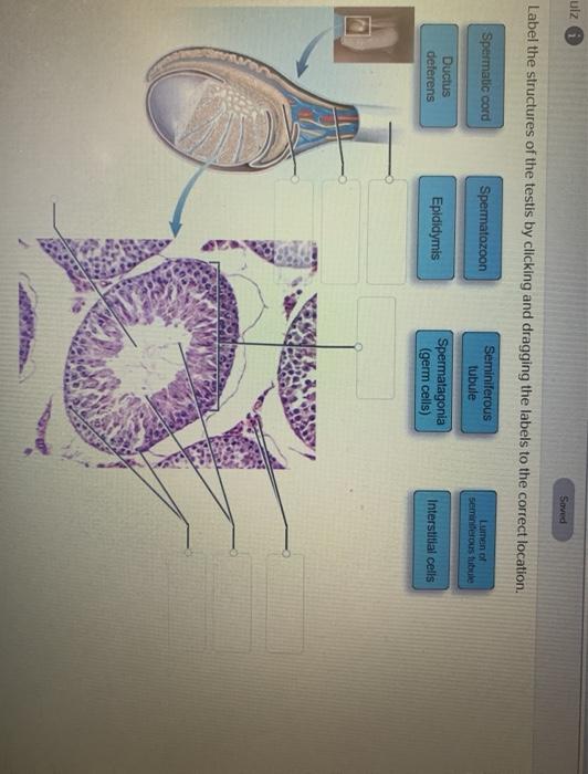Solved ulz Soved Label the structures of the testis by | Chegg.com