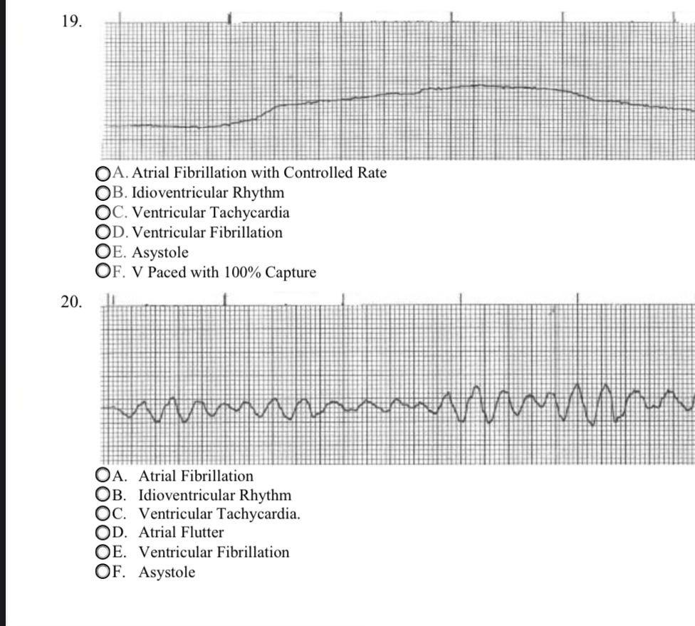 Solved A. Atrial Fibrillation with Controlled Rate B. | Chegg.com