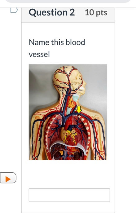 Solved Question 1 10 pts Name this blood vessel (in red) D | Chegg.com Solved Question 1 10 pts Name this blood vessel (in red) D | Chegg.com