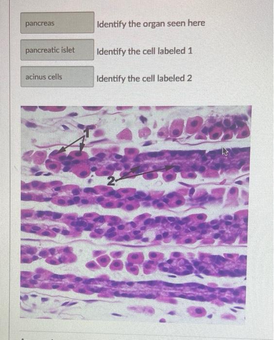 Solved pancreas Identify the organ seen here pancreatic | Chegg.com