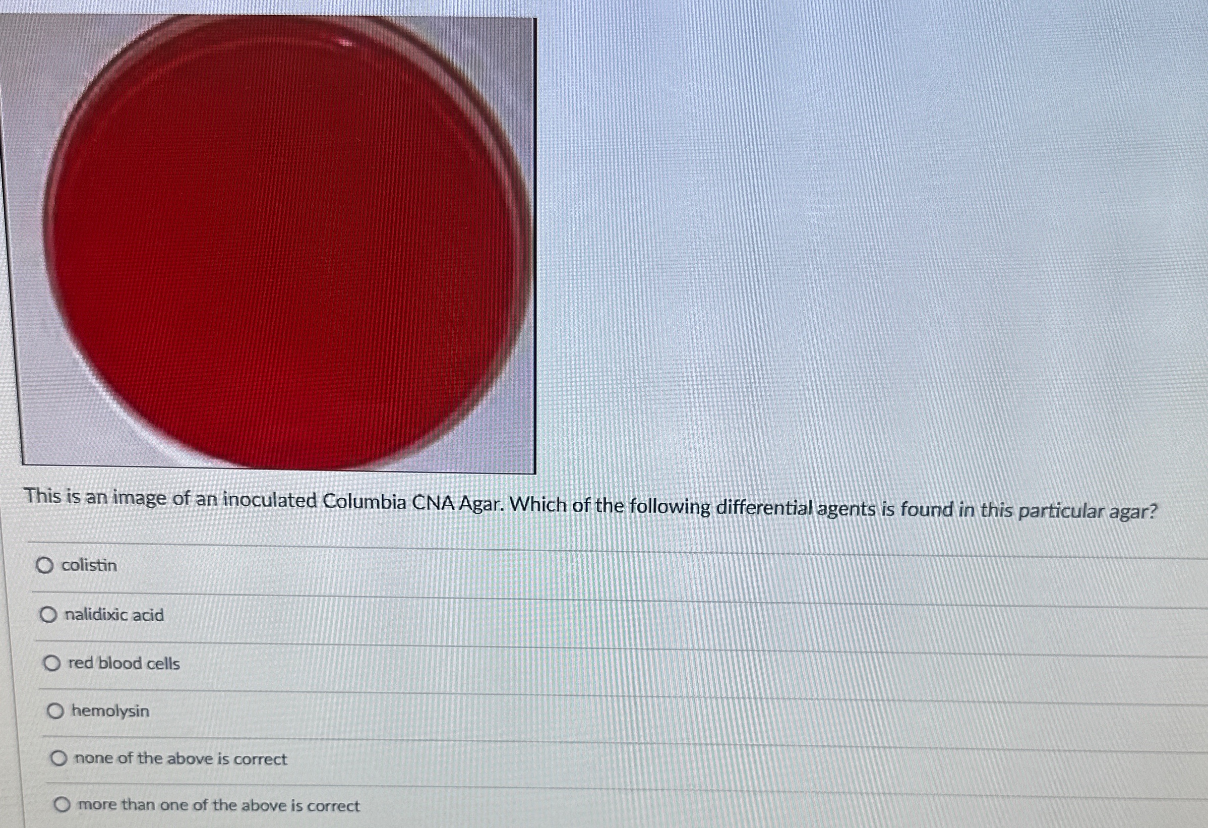 Solved This is an image of an inoculated Columbia CNA Agar. | Chegg.com