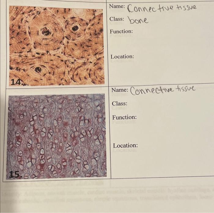 Solved Name: Connec tive tissue class: bone Function: | Chegg.com