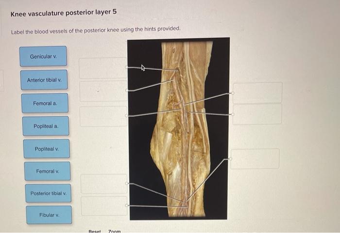 Solved Knee vasculature posterior layer 5 Label the blood | Chegg.com