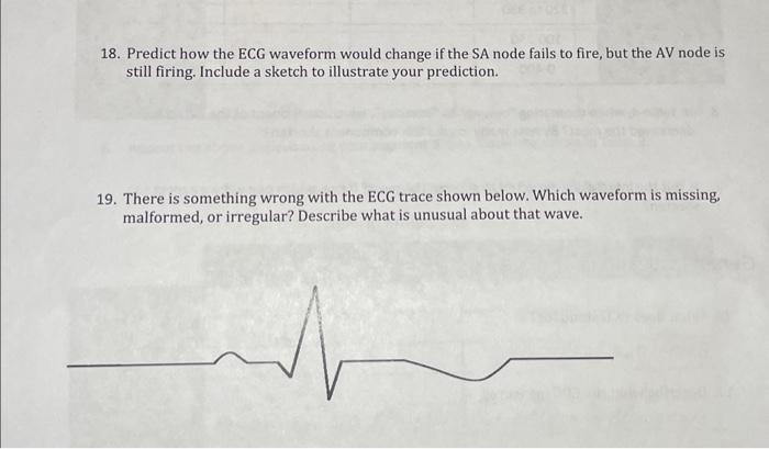 Solved 18. Predict how the ECG waveform would change if the | Chegg.com