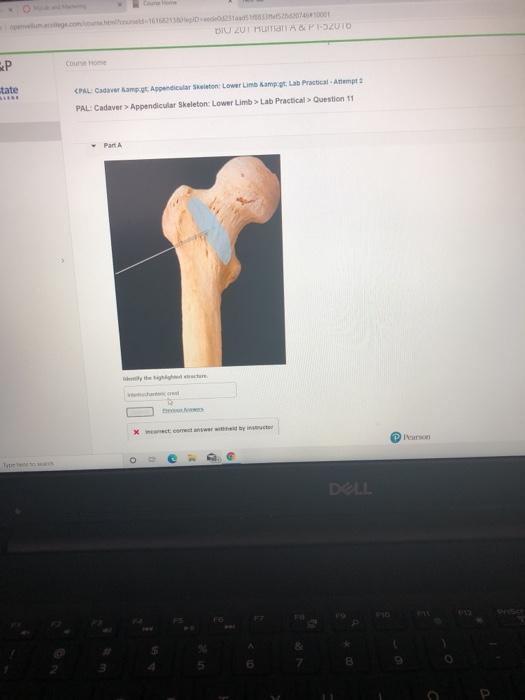 Solved Appendicular Skeleton: Lower | Chegg.com