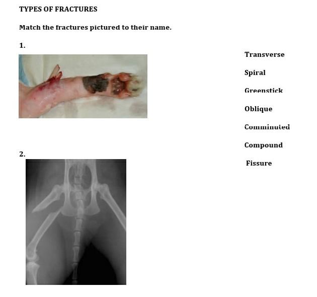 Solved TYPES OF FRACTURES Match the fractures pictured to | Chegg.com