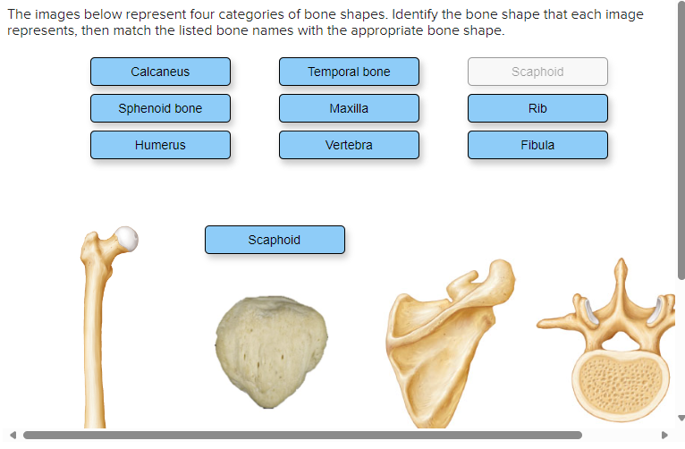 Solved The images below represent four categories of bone | Chegg.com