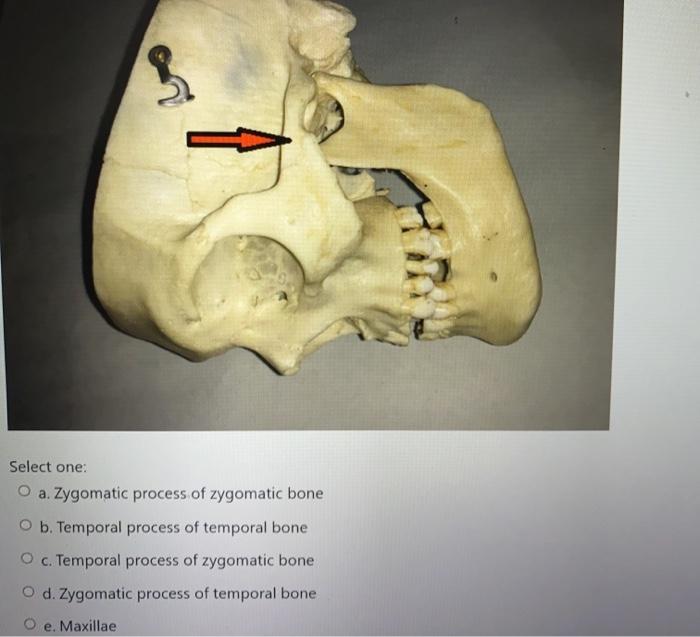 Zygomatic Process