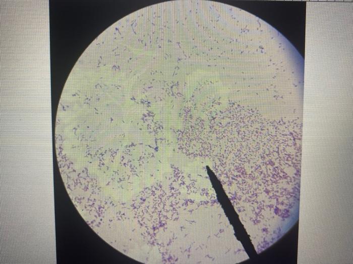 Solved identify and analyze the unknown bacteria and API | Chegg.com
