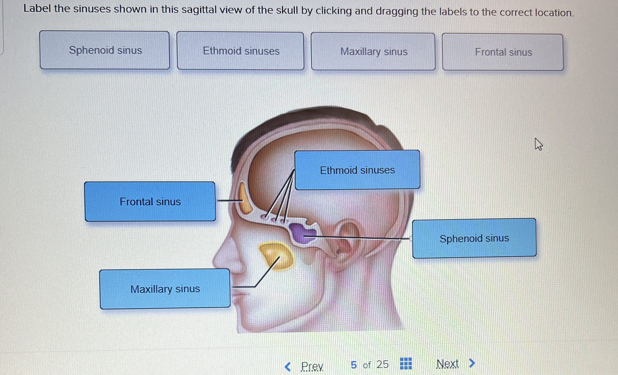 Solved Label the sinuses shown in this sagittal view of the | Chegg.com