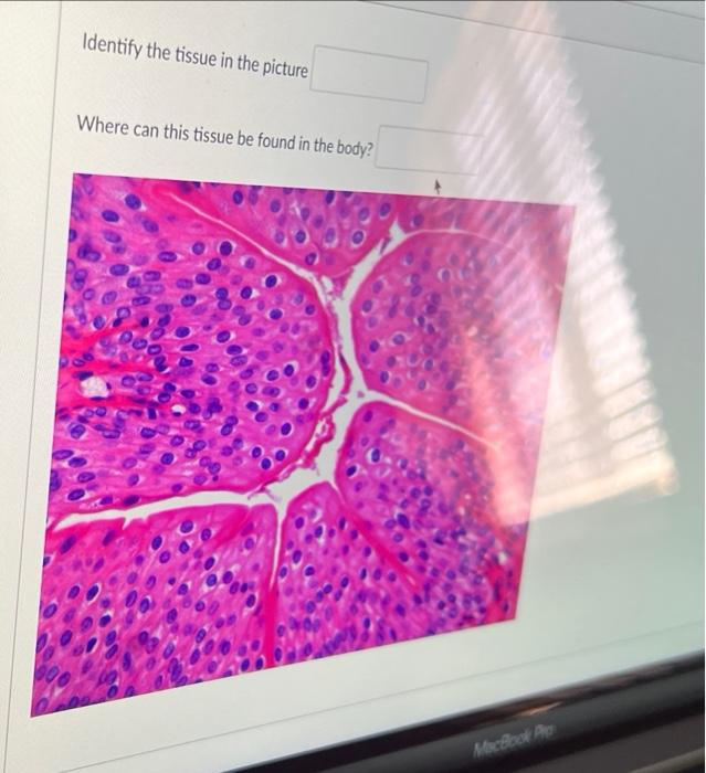 Identify this tissue Identify the cell at the pointer | Chegg.com
