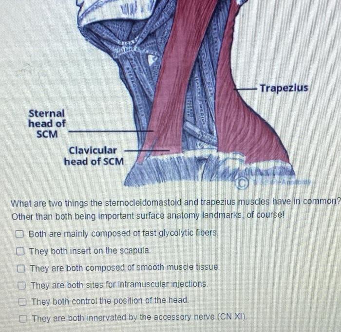 Solved Trapezlus Sternal head of SCM Clavicular head of SCM | Chegg.com