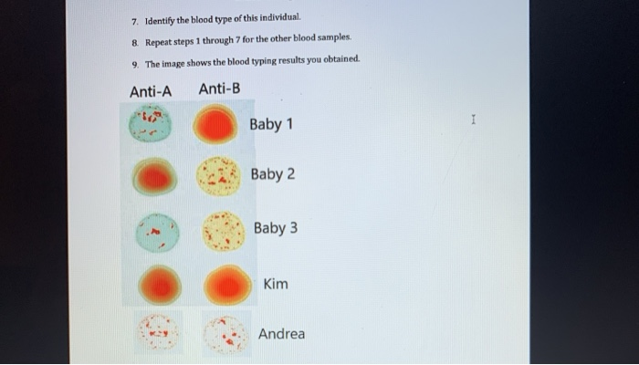 Solved Table 1. Blood typing results. In the table below, | Chegg.com