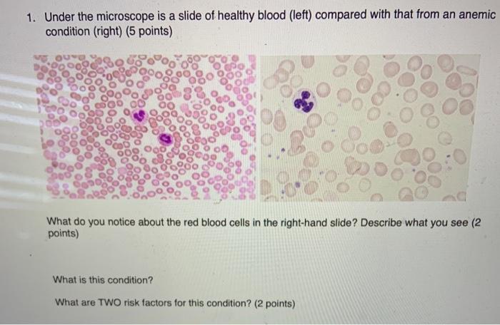 Solved 1. Under the microscope is a slide of healthy blood | Chegg.com