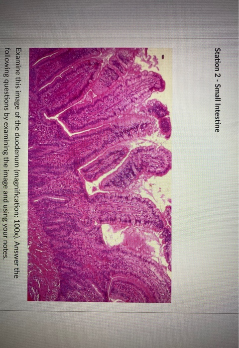 Solved Station 2 - Small intestine Examine this image of the | Chegg.com