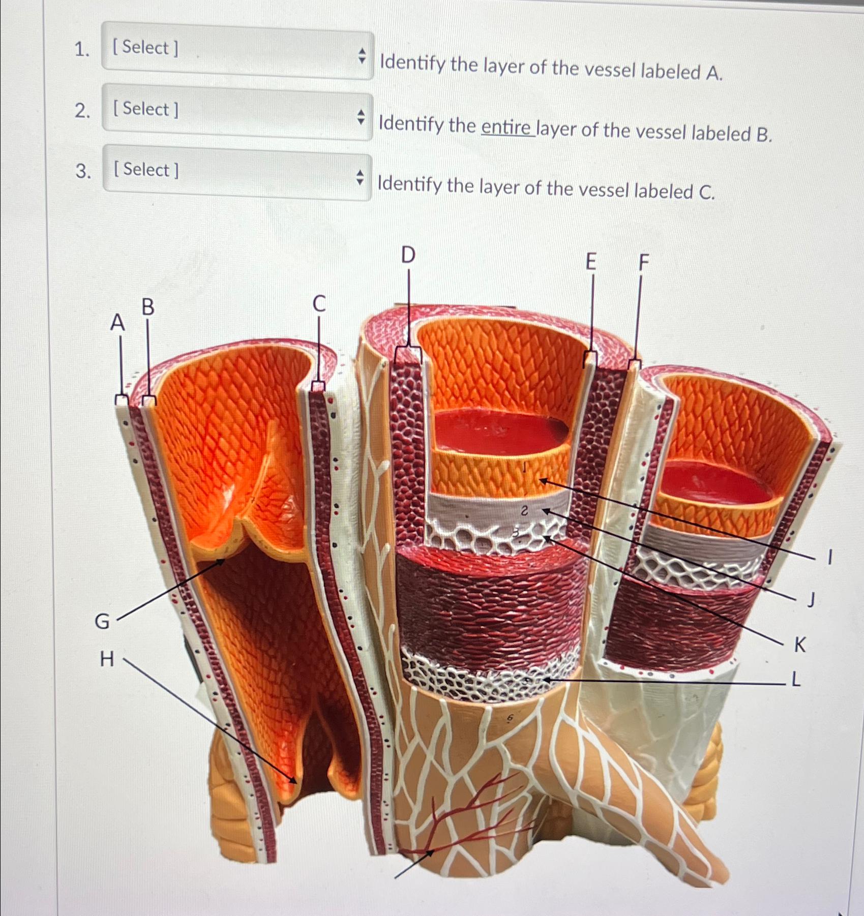 Solved Identify the layer of the vessel labeled A.Identify | Chegg.com