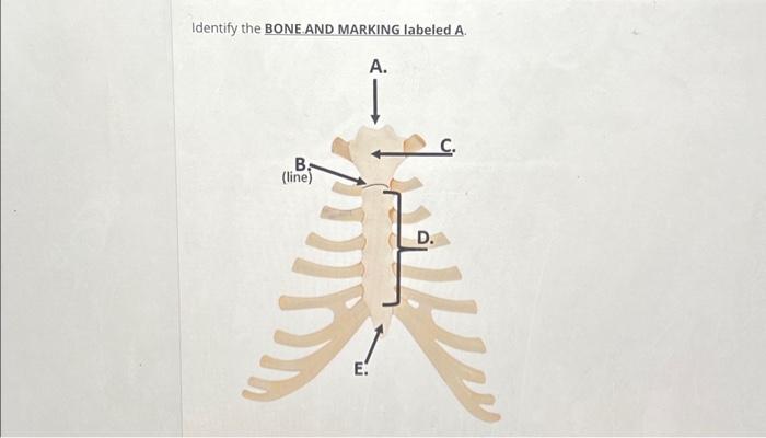 Solved Identify the BONE AND MARKING labeled A. A. B. (line) | Chegg.com