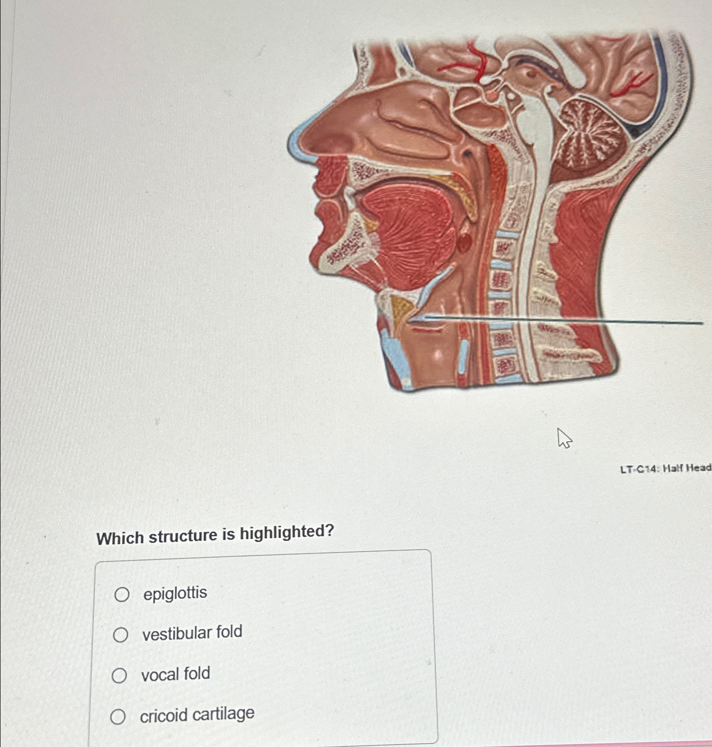 Solved Which structure is highlighted?epiglottisvestibular | Chegg.com