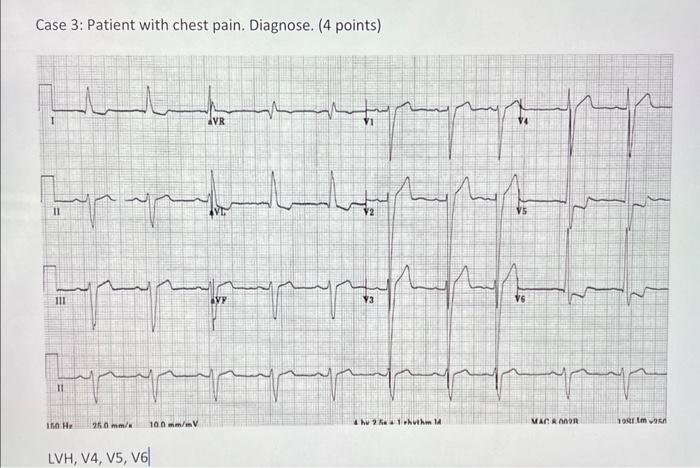 Solved Case 1: 48-year-old man with PMHx of diabetes. | Chegg.com