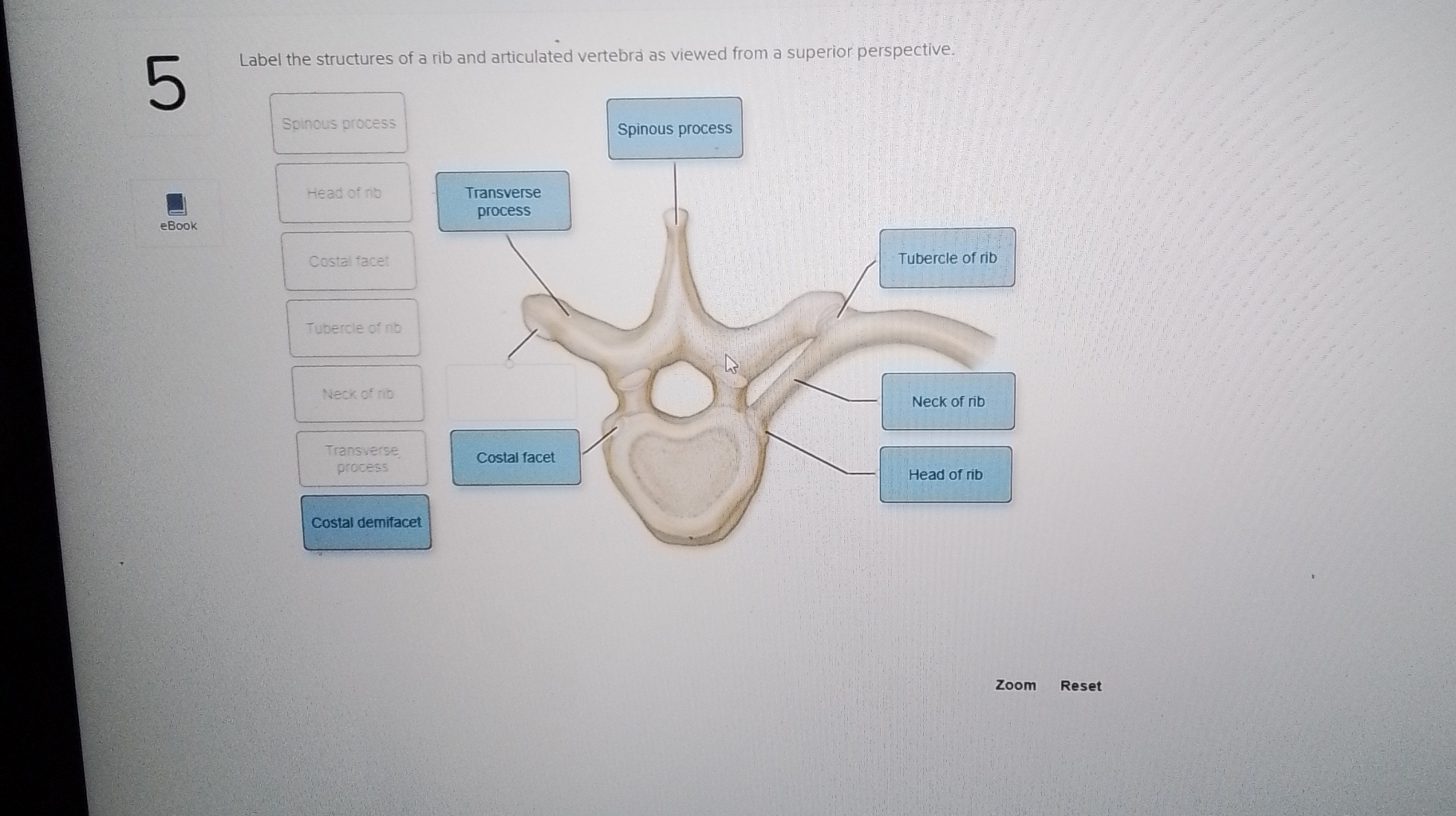 Solved Label tha ntruntuiras af a rih and artirulated | Chegg.com